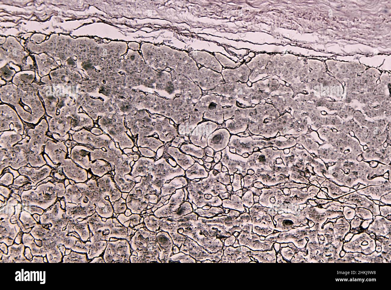 Reticular fibres in human pituitary gland, light micrograph Stock Photo ...