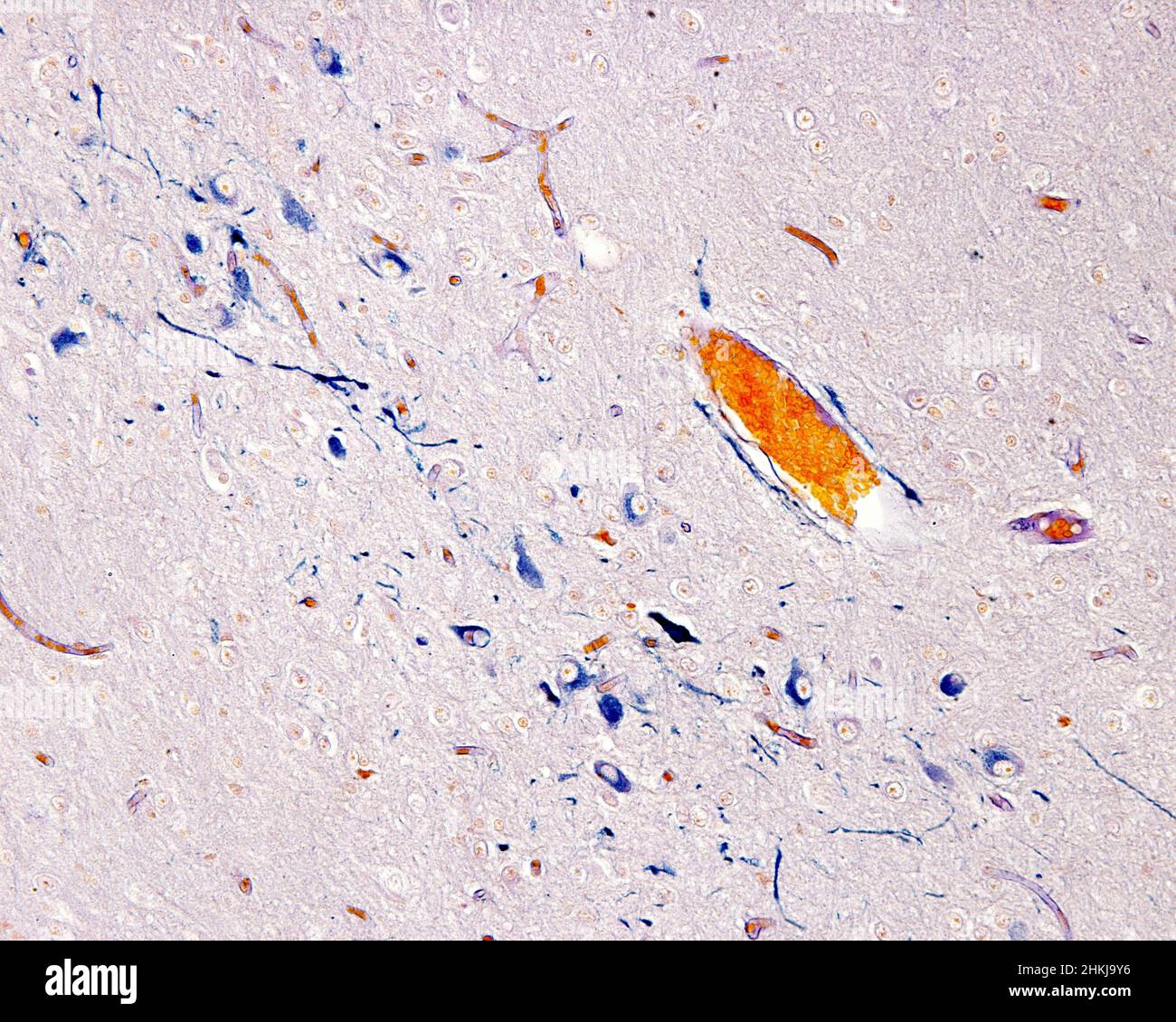 Hypothalamus paraventricular nucleus, light micrograph Stock Photo - Alamy