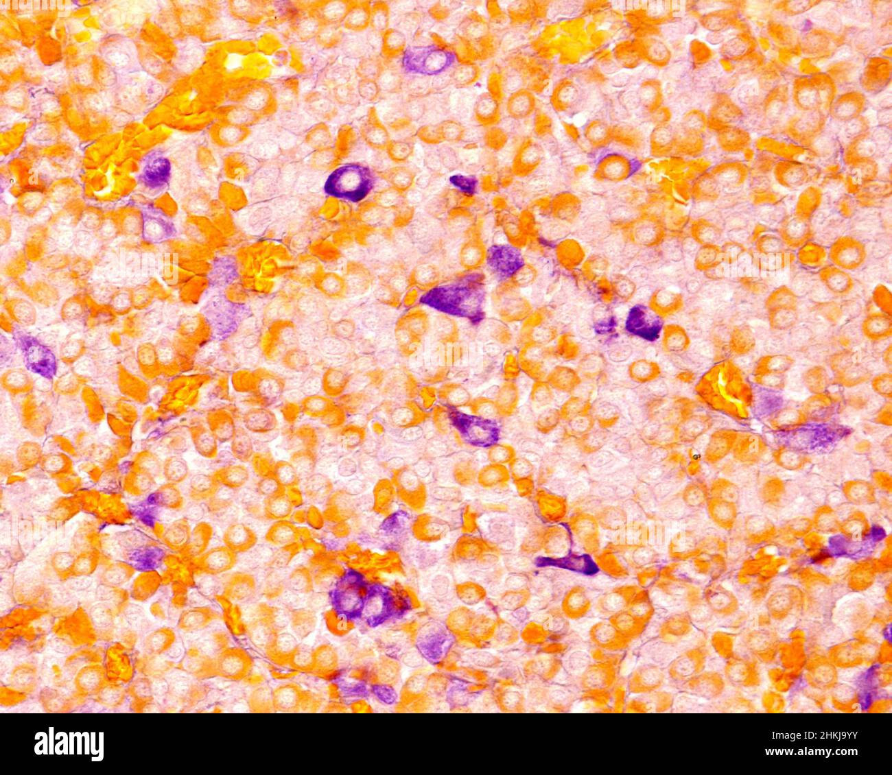 Anterior lobe of pituitary gland, light micrograph Stock Photo - Alamy
