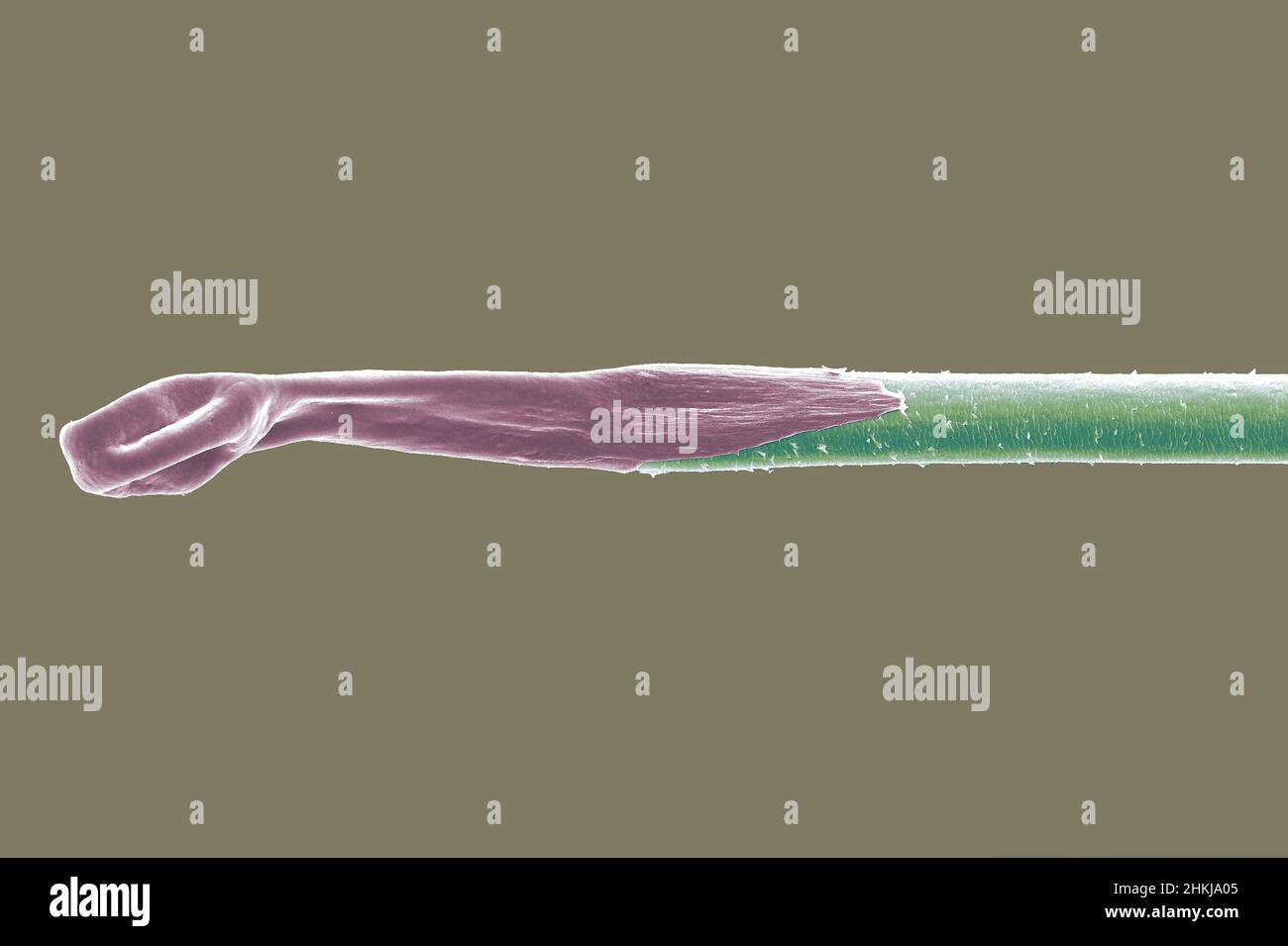 Human hair bulb, SEM Stock Photo - Alamy