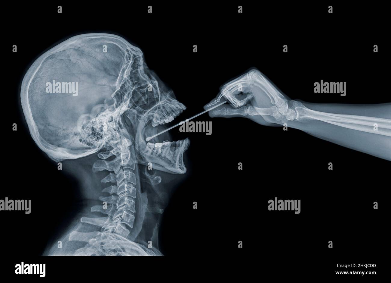 Person receiving Covid-19 swab test, X-ray Stock Photo - Alamy