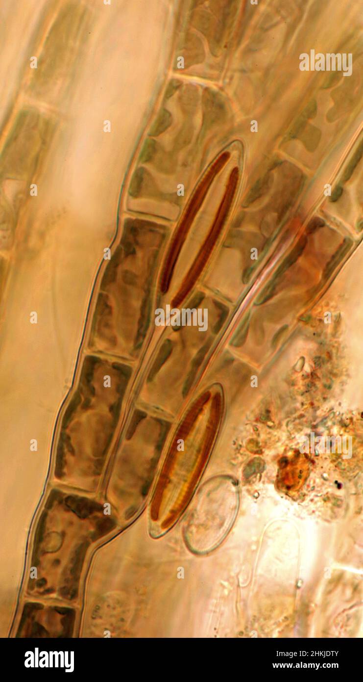 Audouinella sp. red algae and diatoms, light micrograph Stock Photo - Alamy