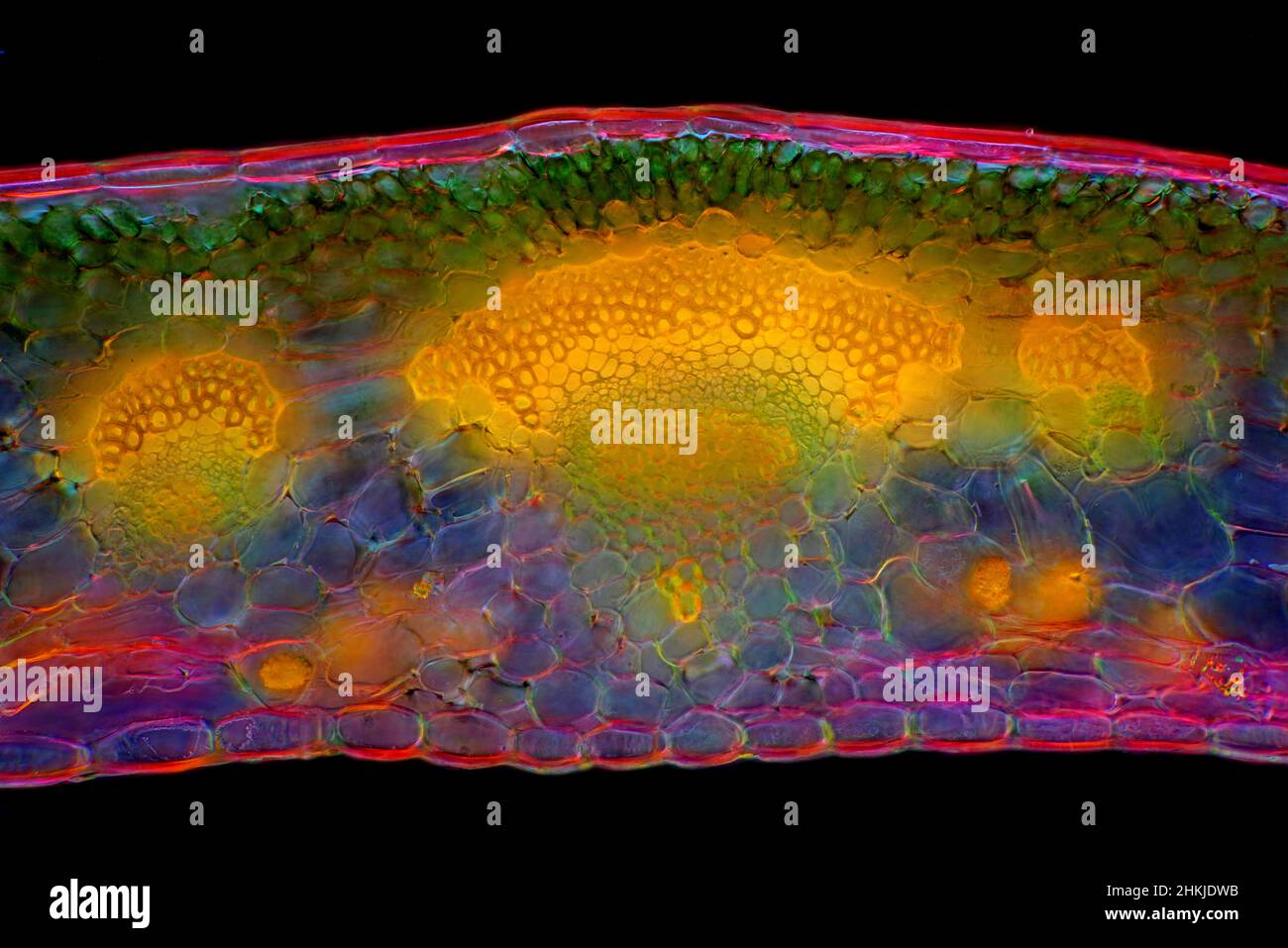 Cheddar pink leaf, light micrograph Stock Photo - Alamy