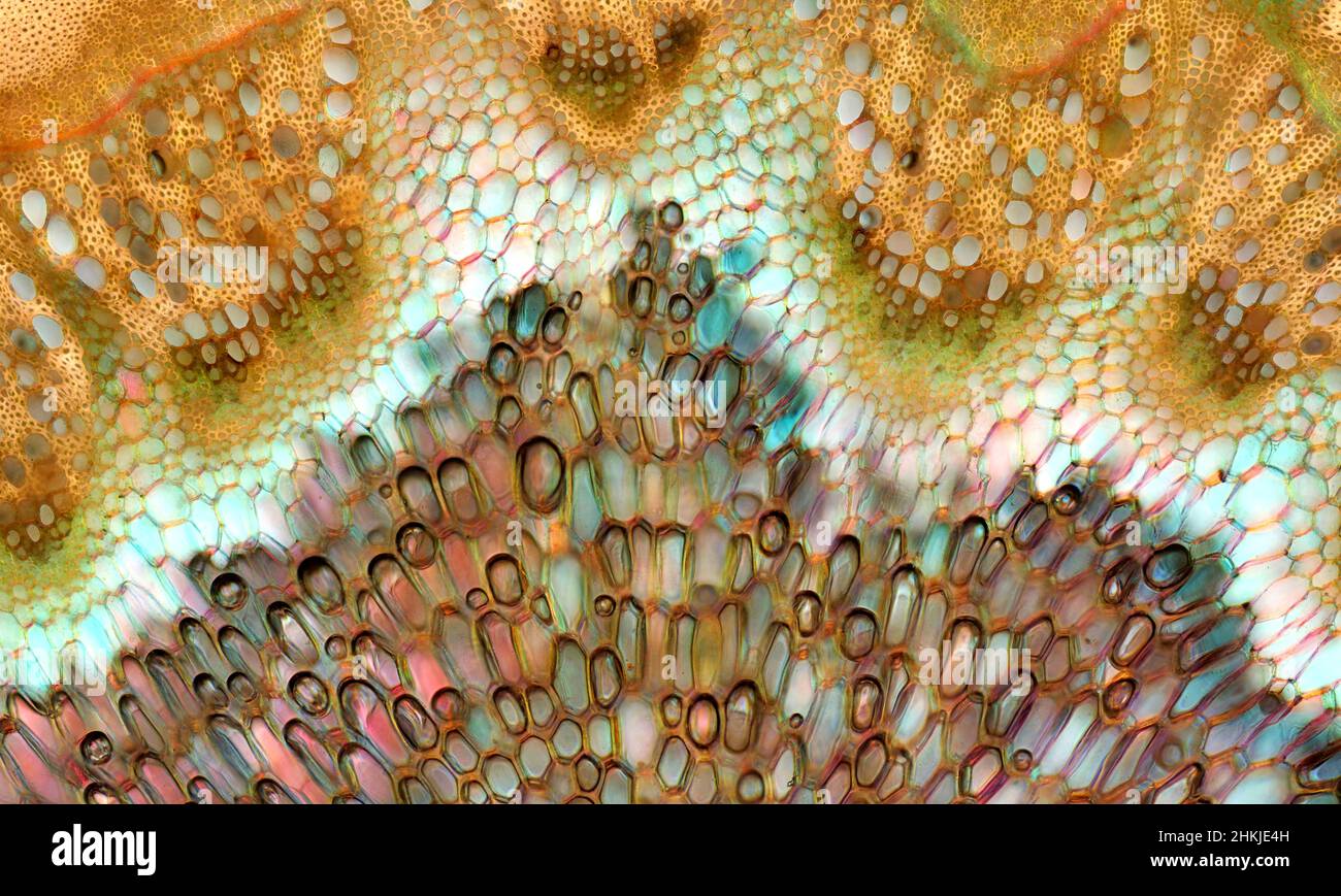 Chenopodium sp. cells with air bubbles, light micrograph Stock Photo ...