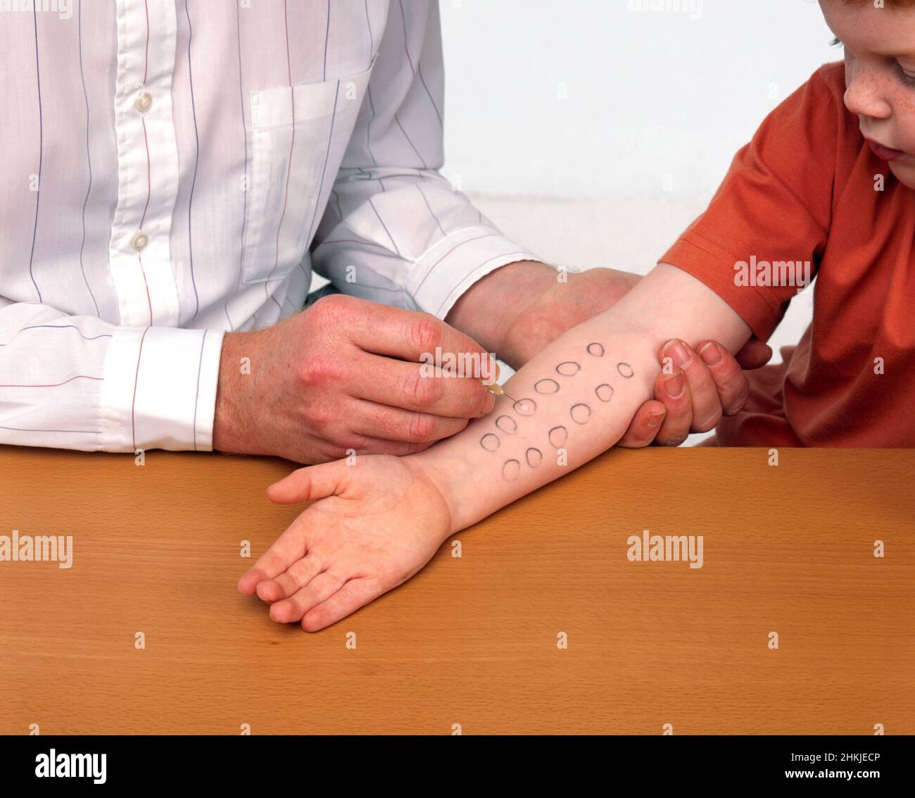 Doctor doing allergy prick test on boy's arm Stock Photo - Alamy