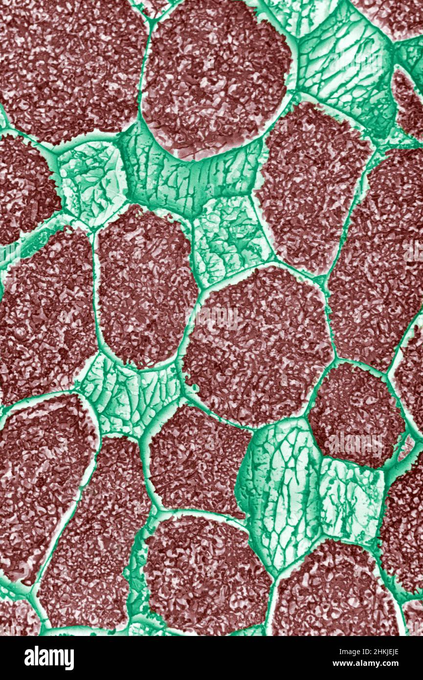 Cell differentiation in a pea root nodule Stock Photo - Alamy