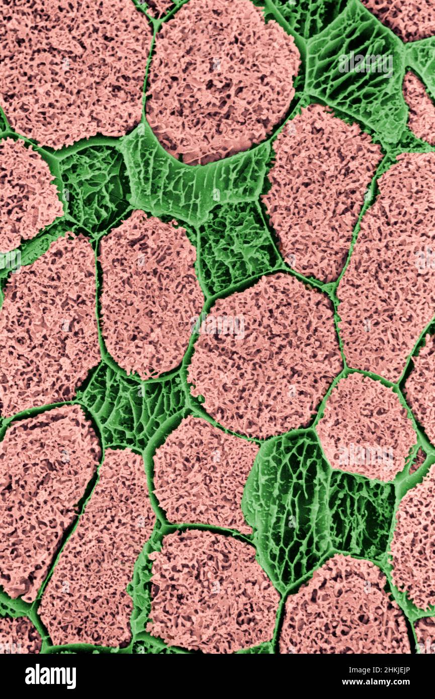 Cell differentiation in a pea root nodule Stock Photo - Alamy