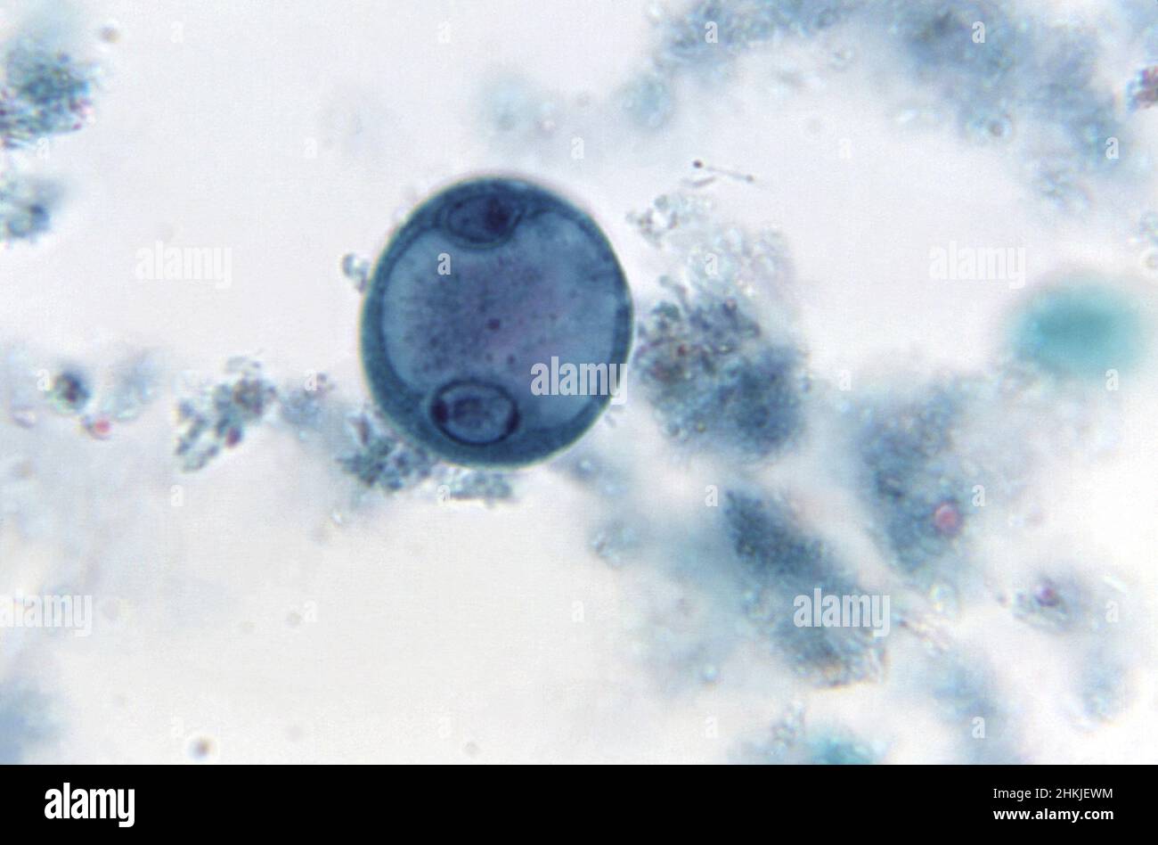 Entamoeba Coli Entamoeba Coli Cyst
