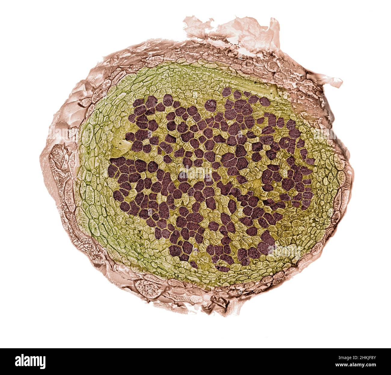 Cross section of a pea root nodule Stock Photo - Alamy