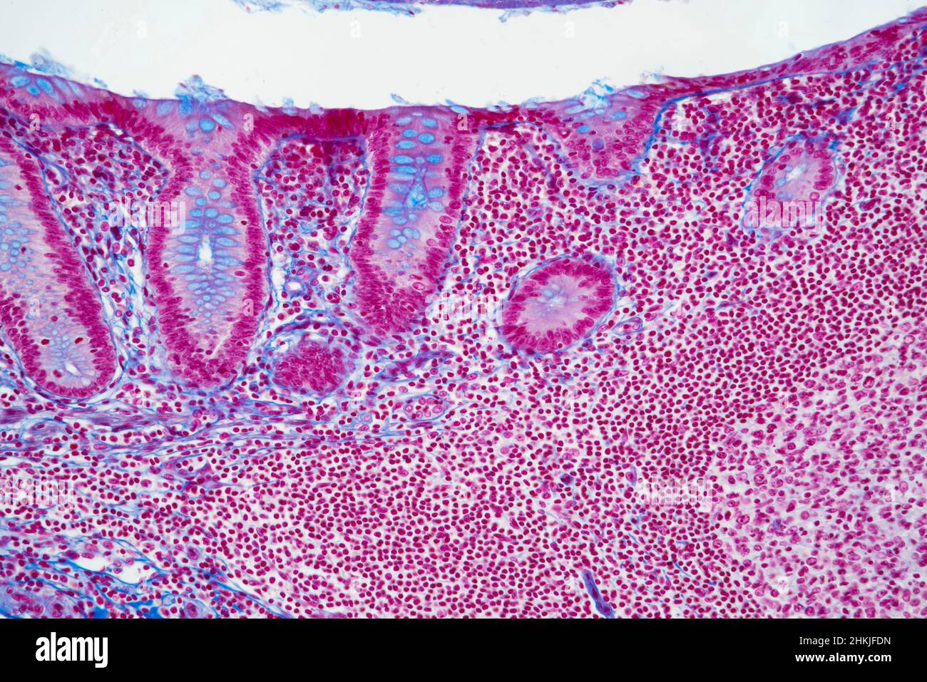 Appendix lining, light micrograph Stock Photo - Alamy
