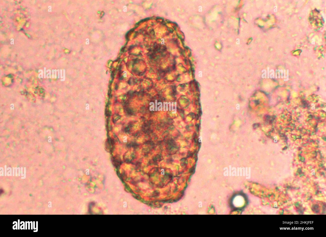 Infertile Ascaris lumbricoides egg, light micrograph Stock Photo - Alamy