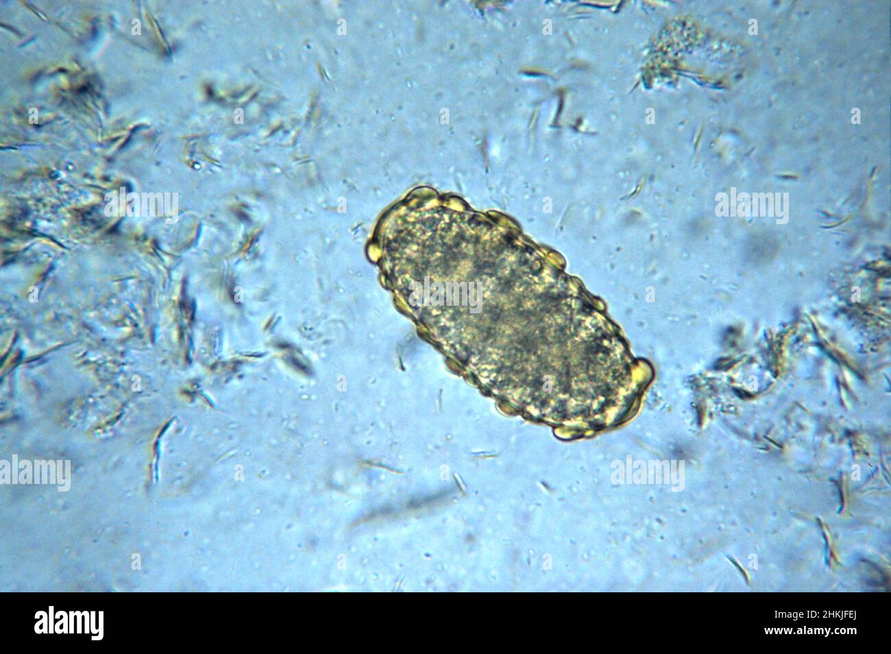 Unfertilised Ascaris lumbricoides egg, light micrograph Stock Photo - Alamy
