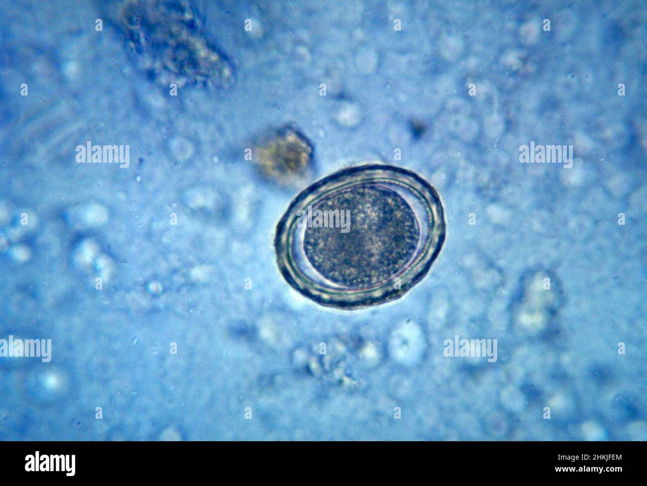 Ascaris Lumbricoides Egg Photo
