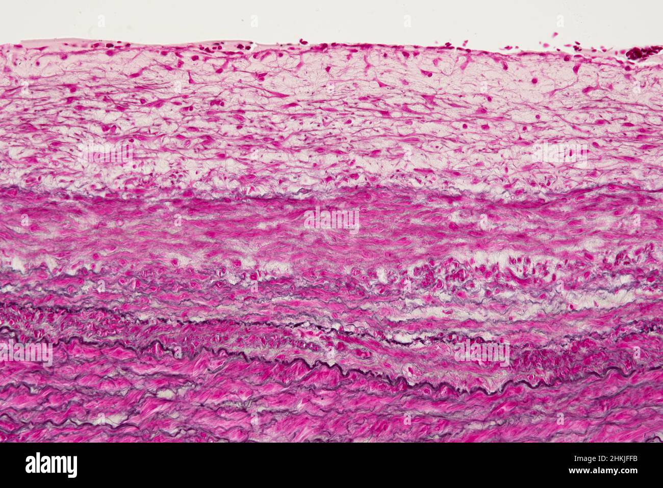 Aorta, light micrograph Stock Photo - Alamy