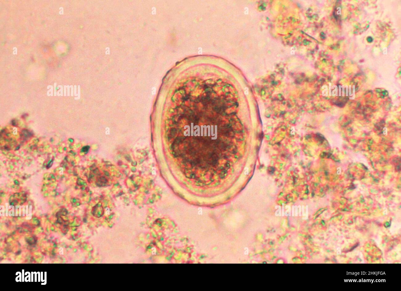 Ascaris lumbricoides egg, light micrograph Stock Photo - Alamy