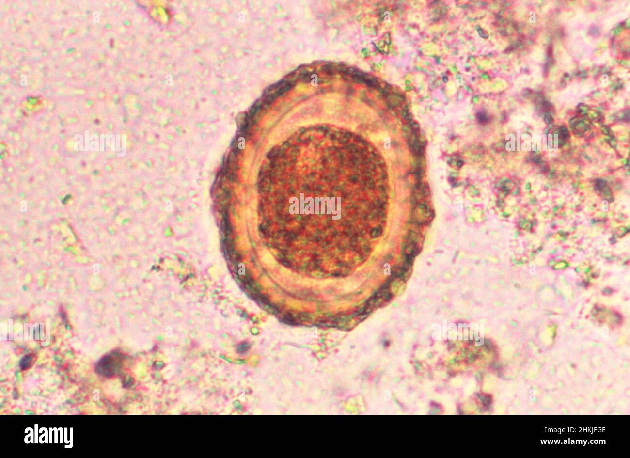 Ascaris lumbricoides egg, light micrograph Stock Photo - Alamy