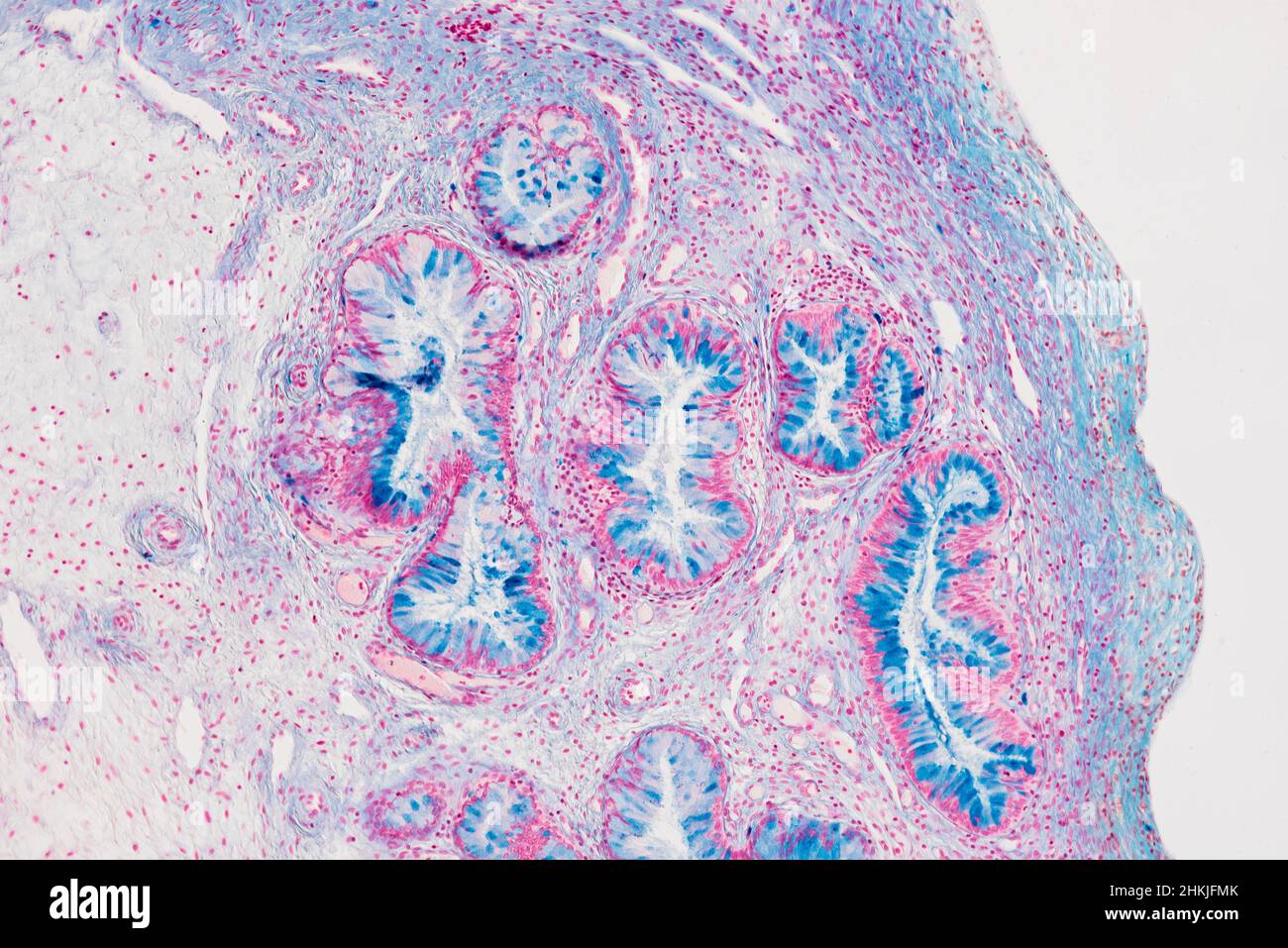 Cervix, light micrograph Stock Photo - Alamy
