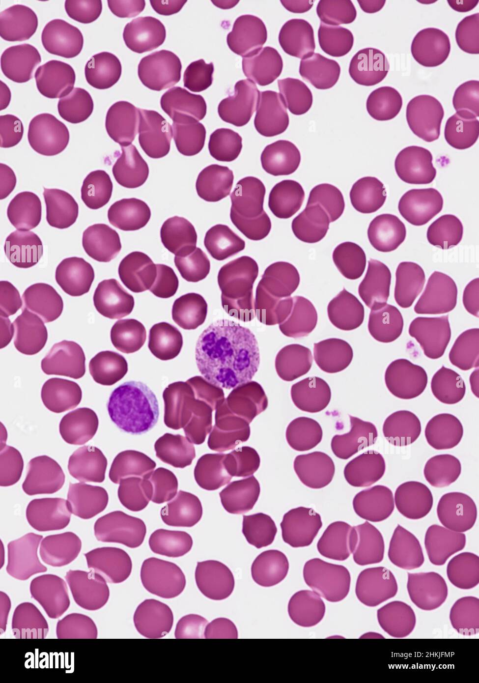 Blood smear, light micrograph Stock Photo - Alamy