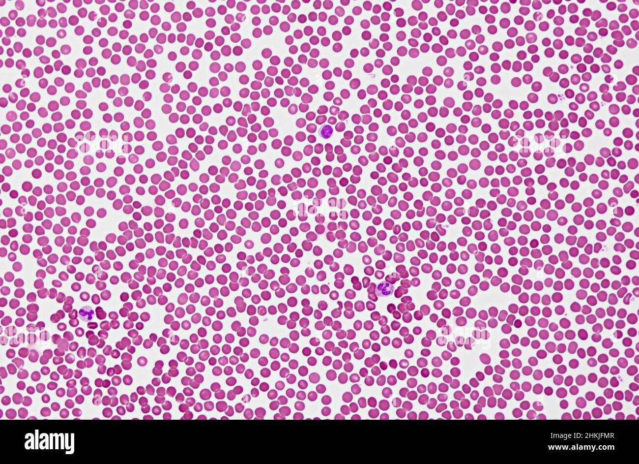 Blood smear, light micrograph Stock Photo - Alamy