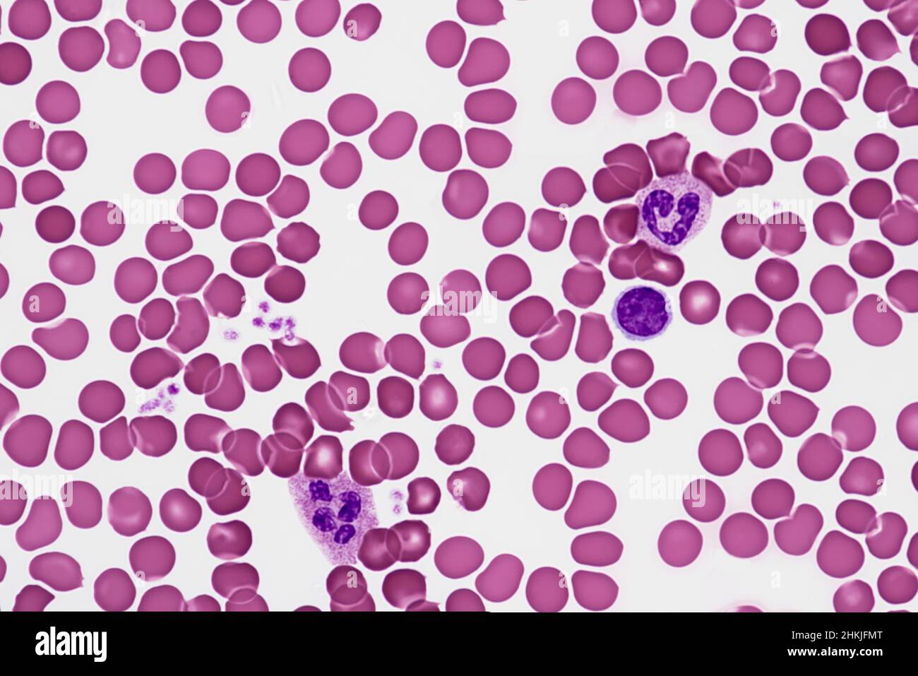 Blood smear, light micrograph Stock Photo - Alamy