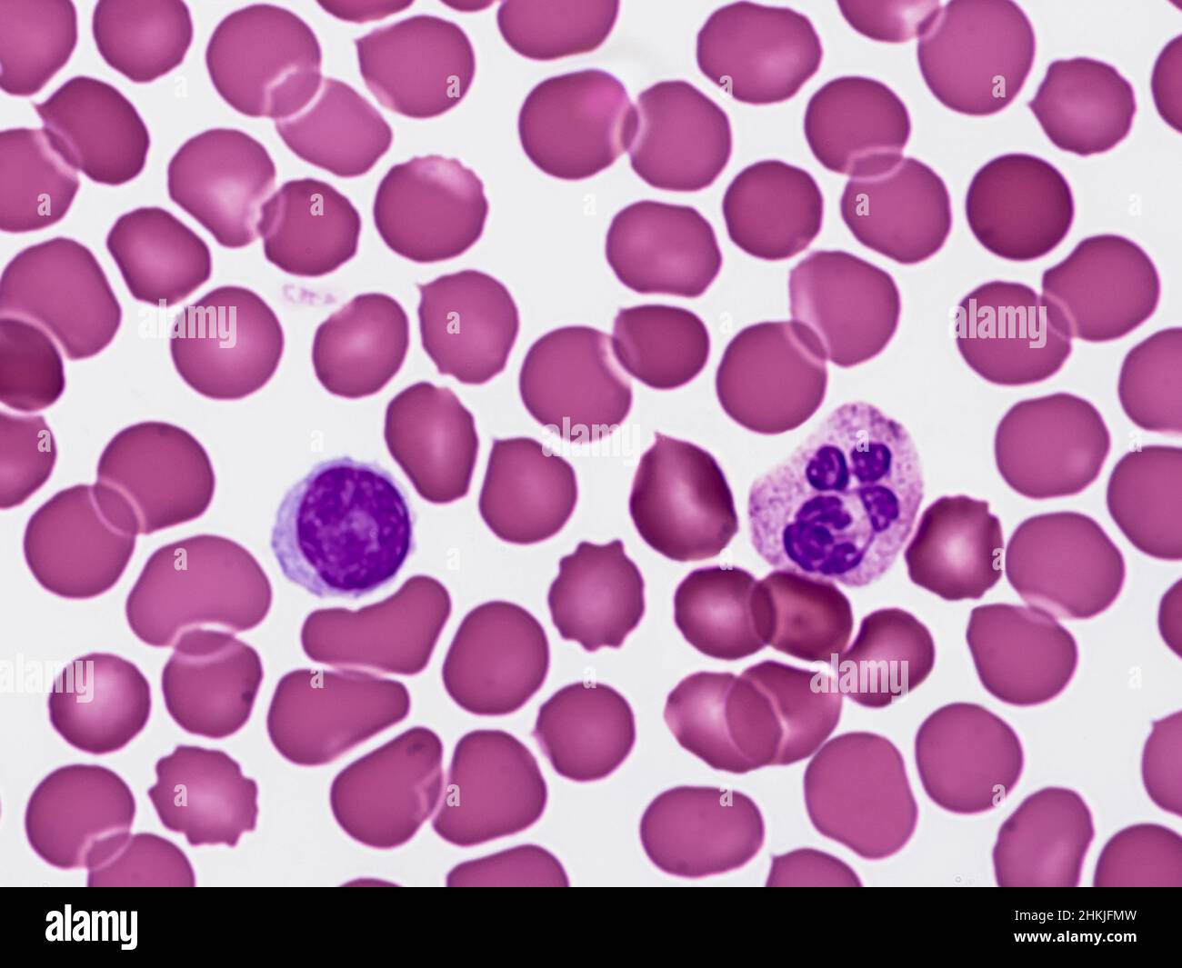 Blood smear, light micrograph Stock Photo - Alamy