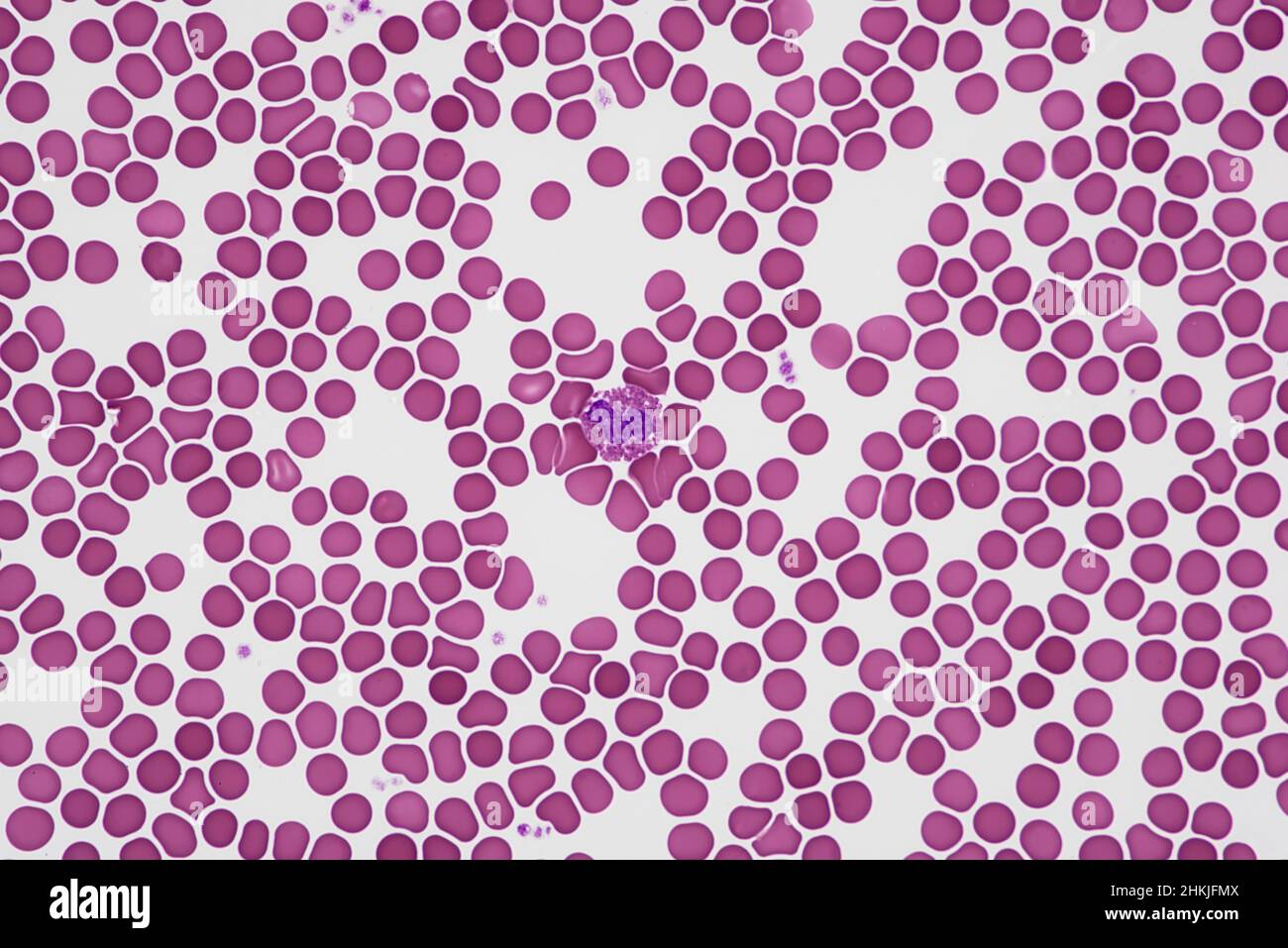 Blood smear, light micrograph Stock Photo - Alamy