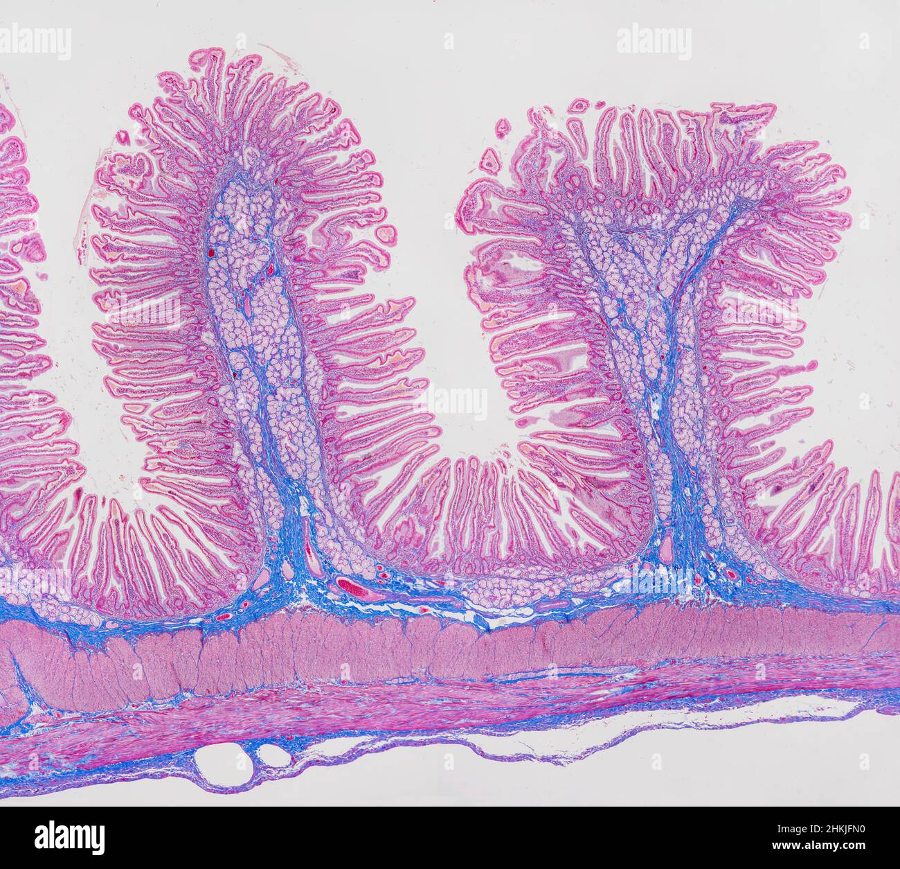 Small intestine, light micrograph Stock Photo - Alamy