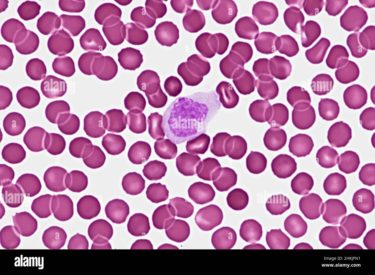 Blood smear, light micrograph Stock Photo - Alamy