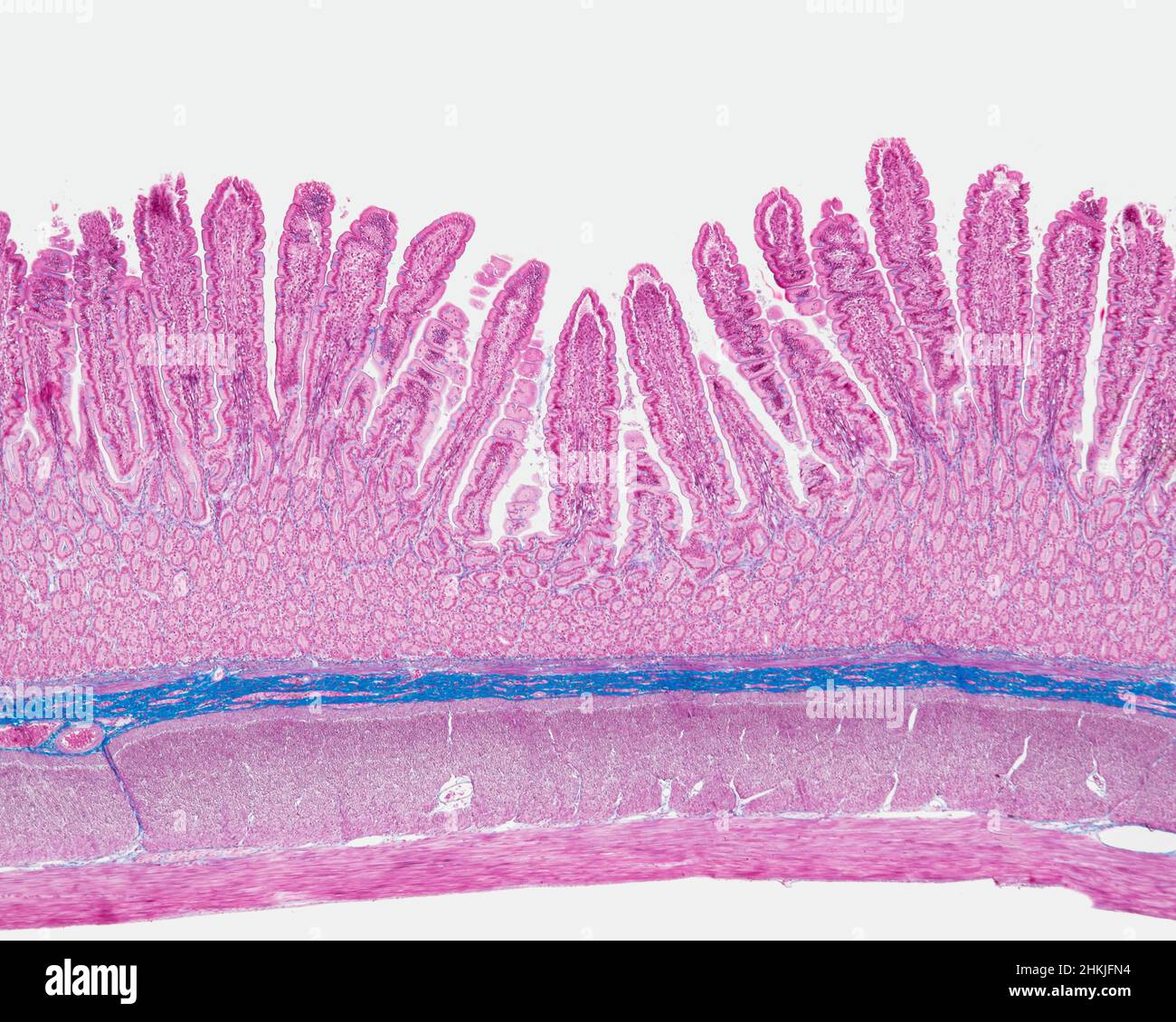 Small intestine, light micrograph Stock Photo - Alamy