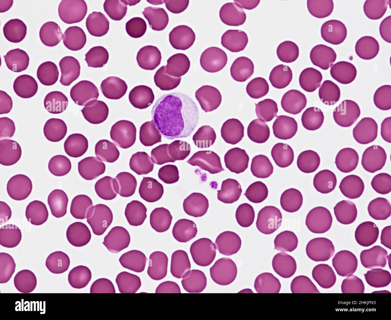 Blood smear, light micrograph Stock Photo - Alamy