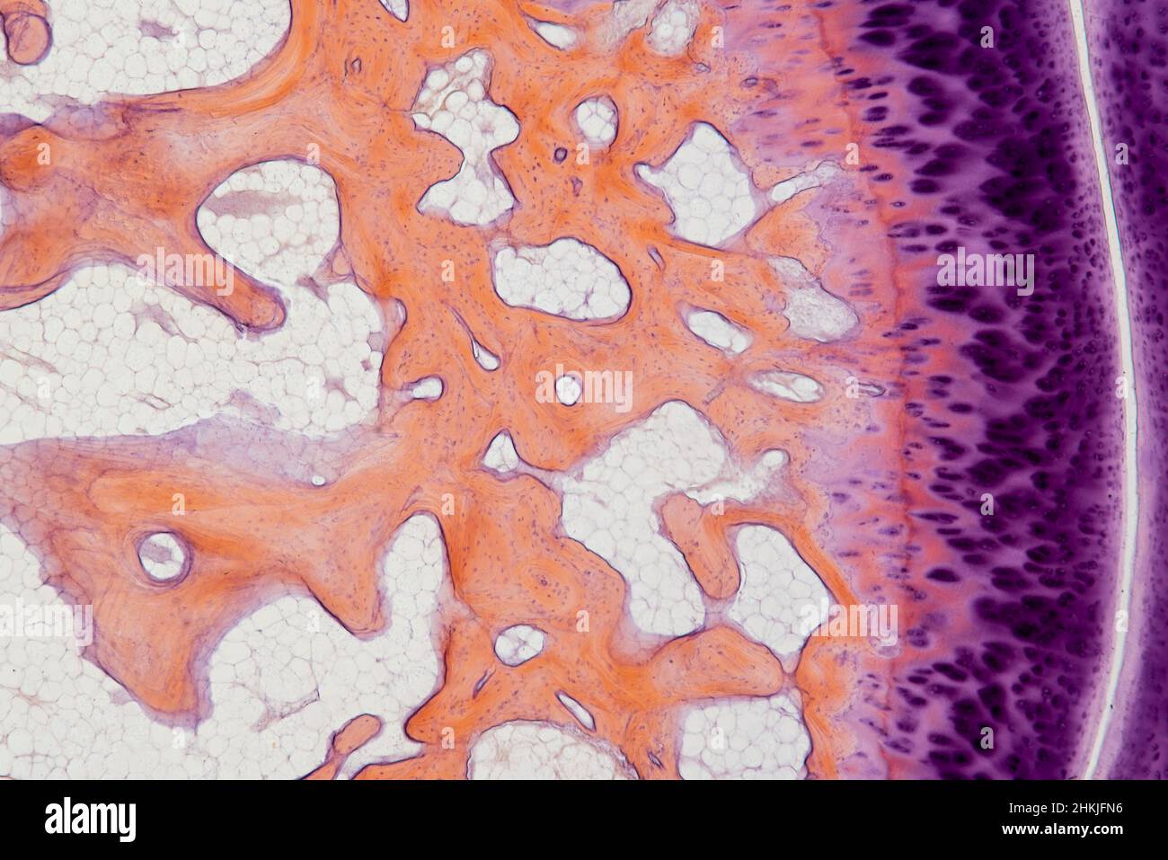 Finger joint, light micrograph Stock Photo - Alamy