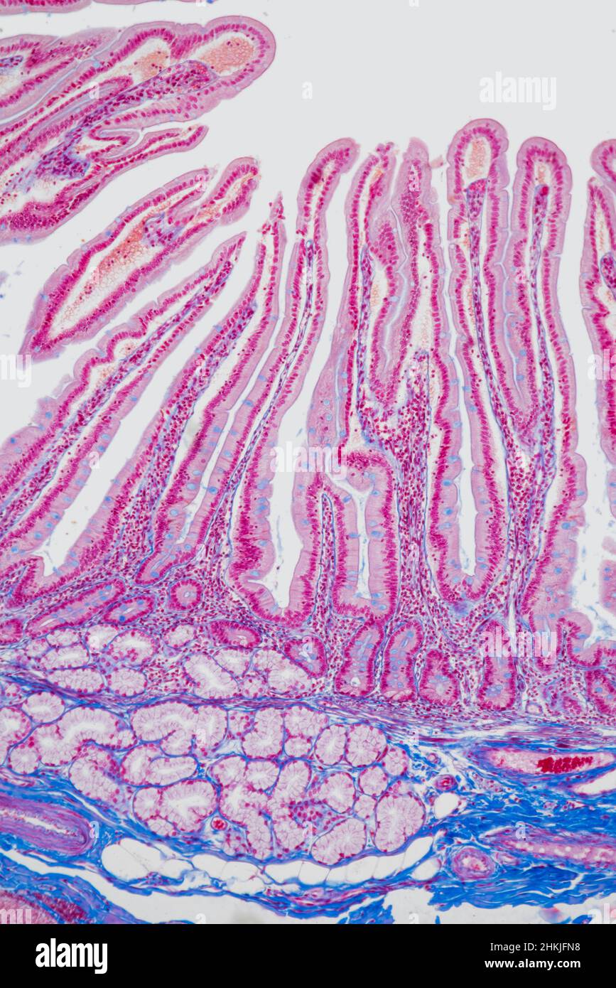 Small intestine, light micrograph Stock Photo - Alamy