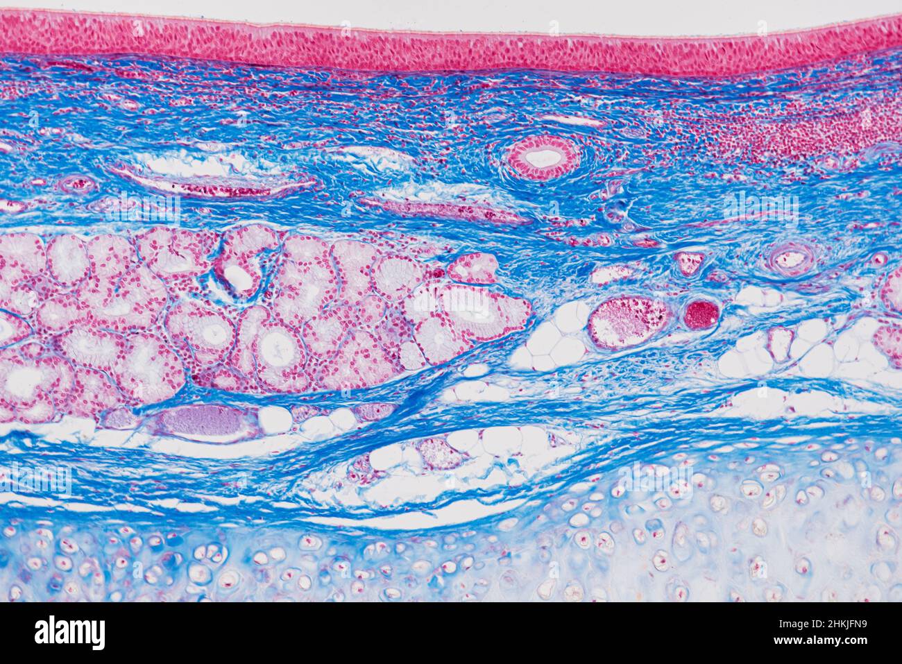 Epiglottis, light micrograph Stock Photo - Alamy