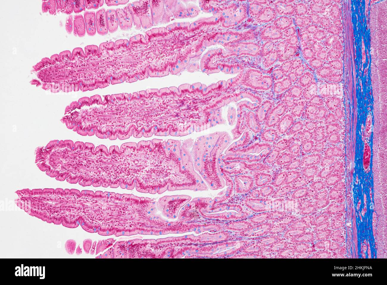 Small intestine, light micrograph Stock Photo - Alamy