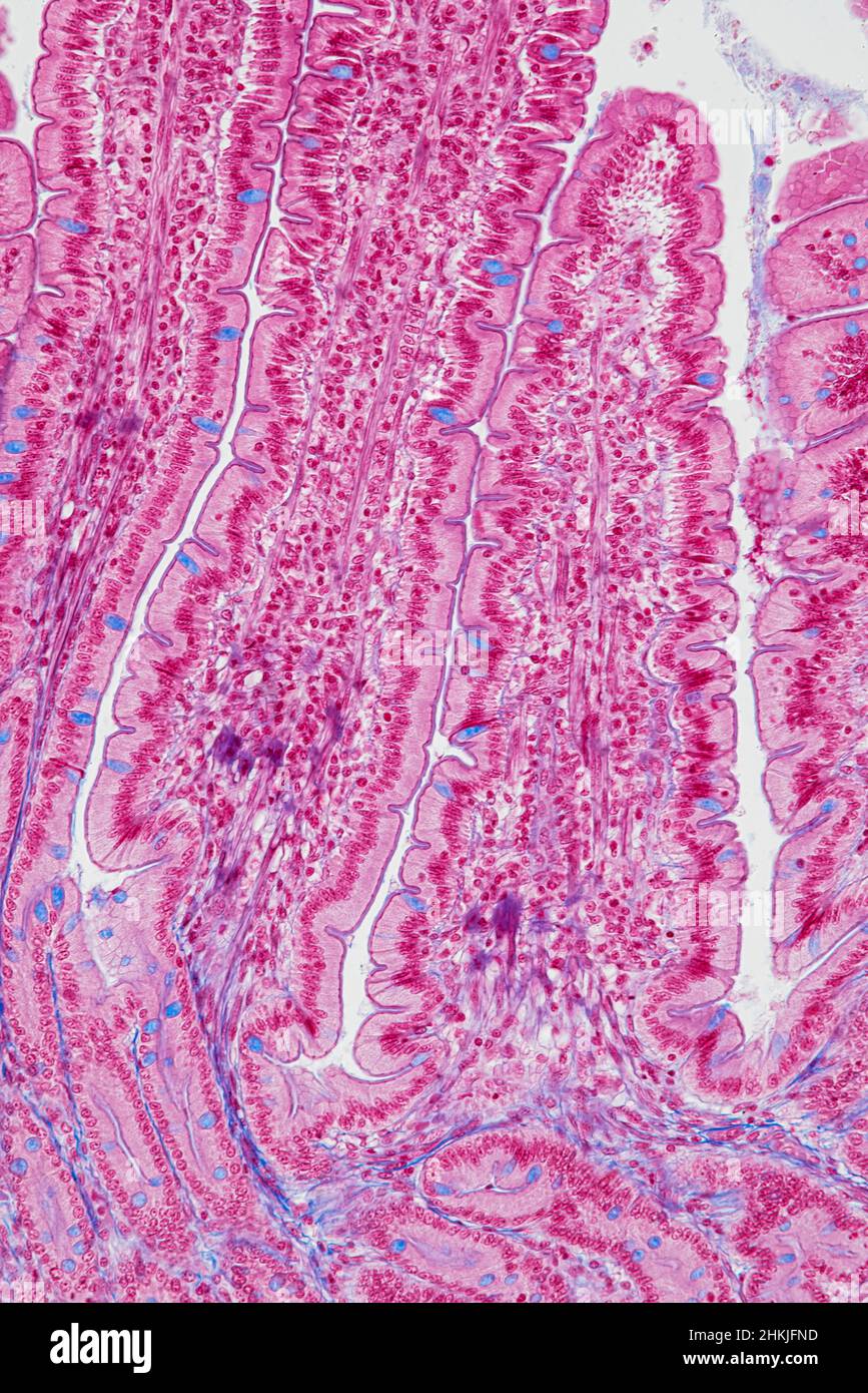 Small intestine, light micrograph Stock Photo - Alamy