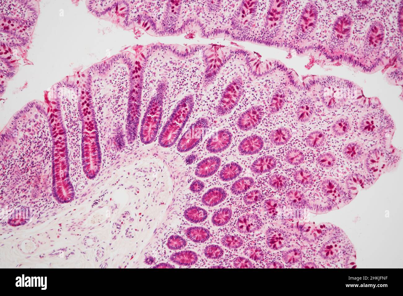 Colon, light micrograph Stock Photo - Alamy