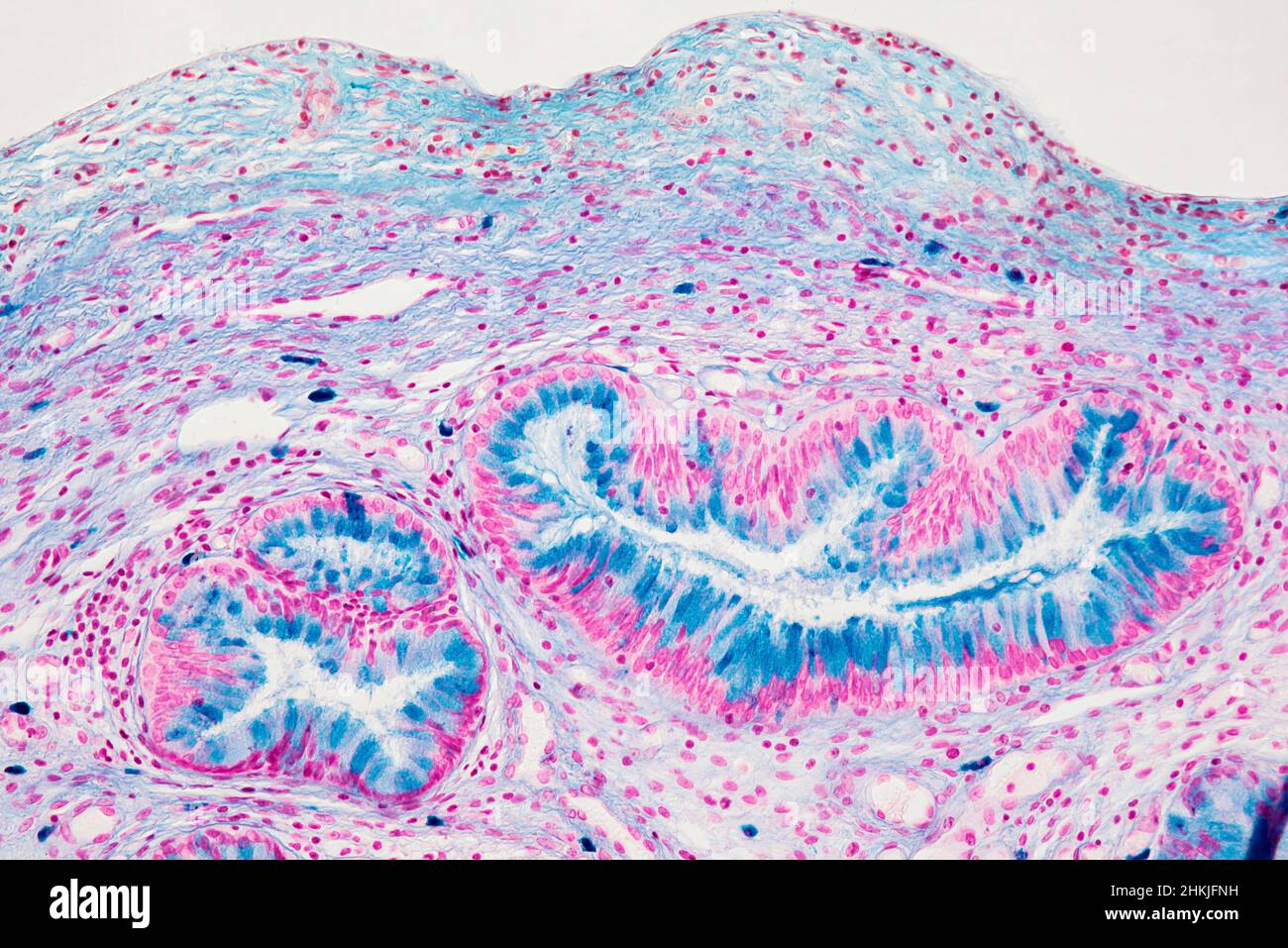 Cervix, light micrograph Stock Photo - Alamy