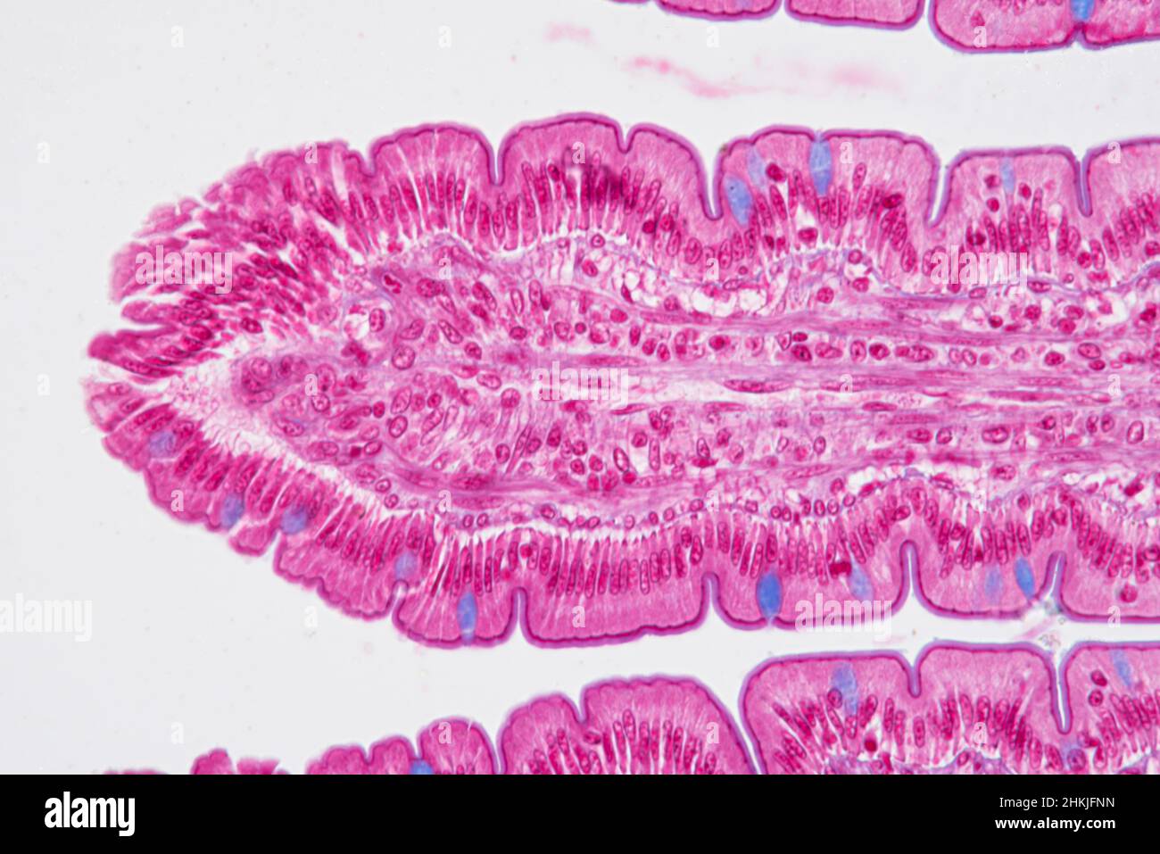 Small intestine, light micrograph Stock Photo - Alamy