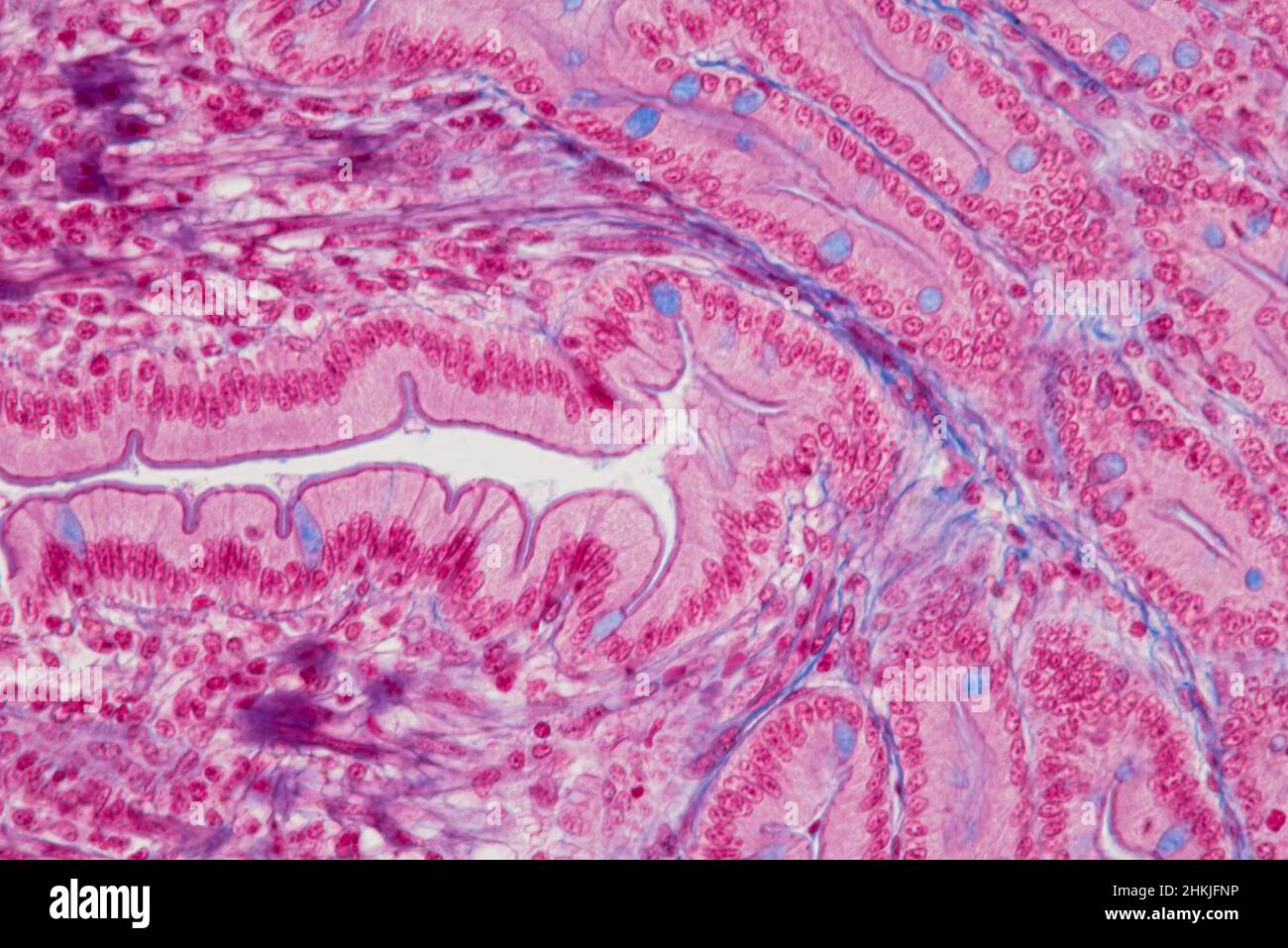 Small intestine, light micrograph Stock Photo - Alamy