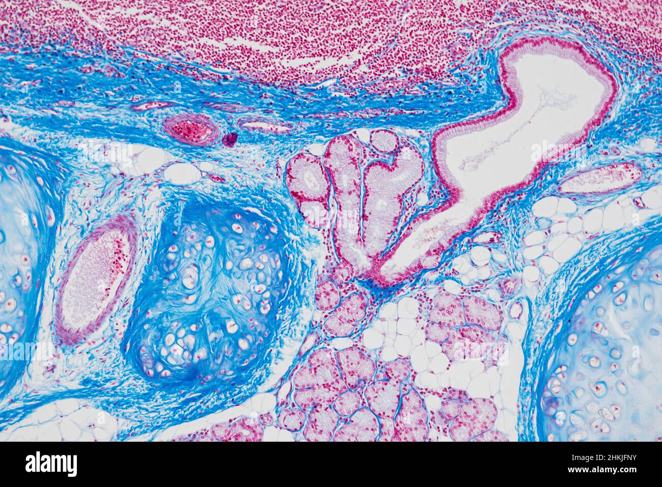 Epiglottis, light micrograph Stock Photo - Alamy
