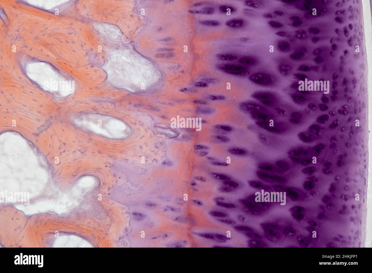 Finger bone, light micrograph Stock Photo - Alamy