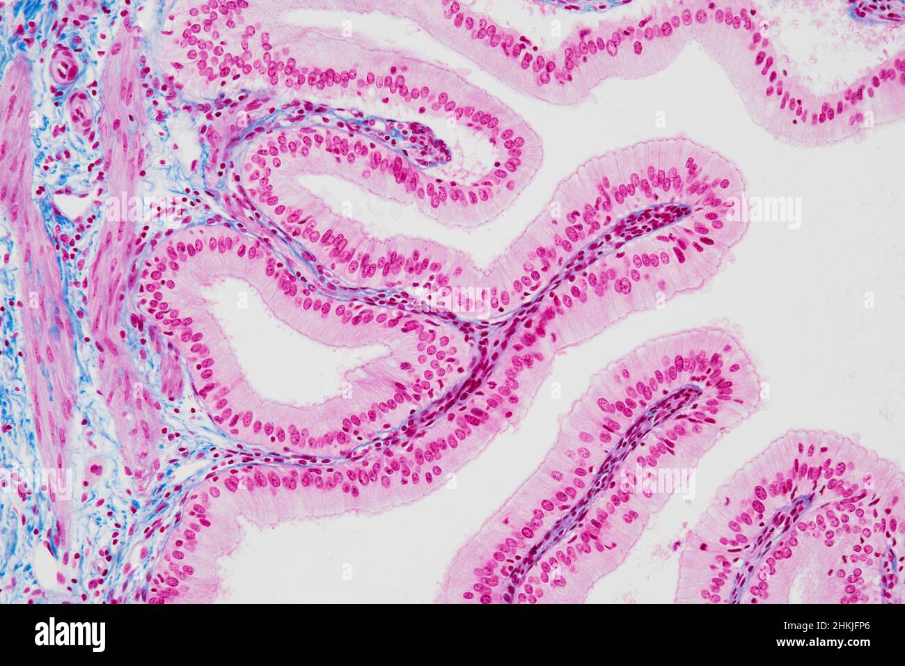 Gallbladder, light micrograph Stock Photo - Alamy