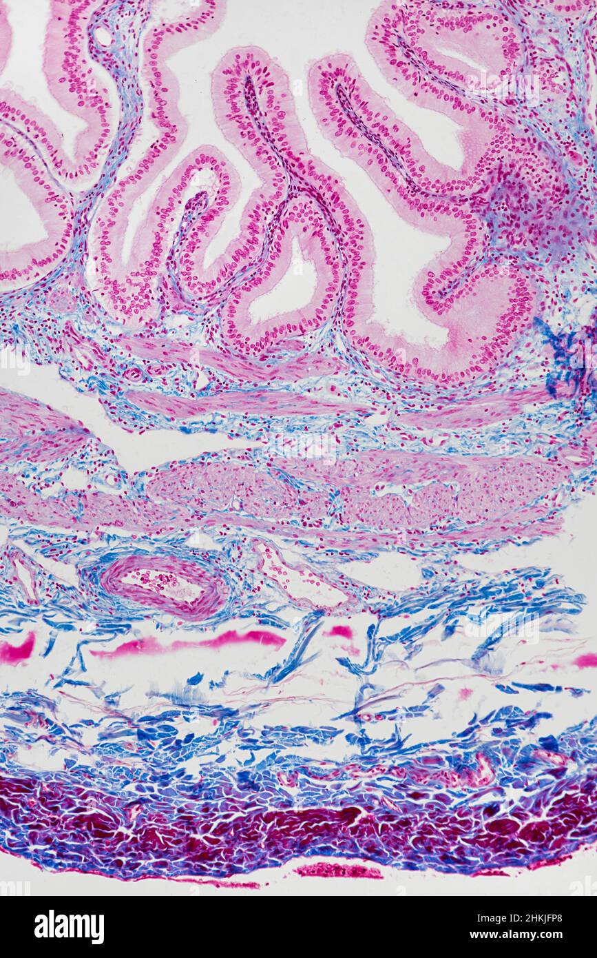 Gallbladder, light micrograph Stock Photo - Alamy