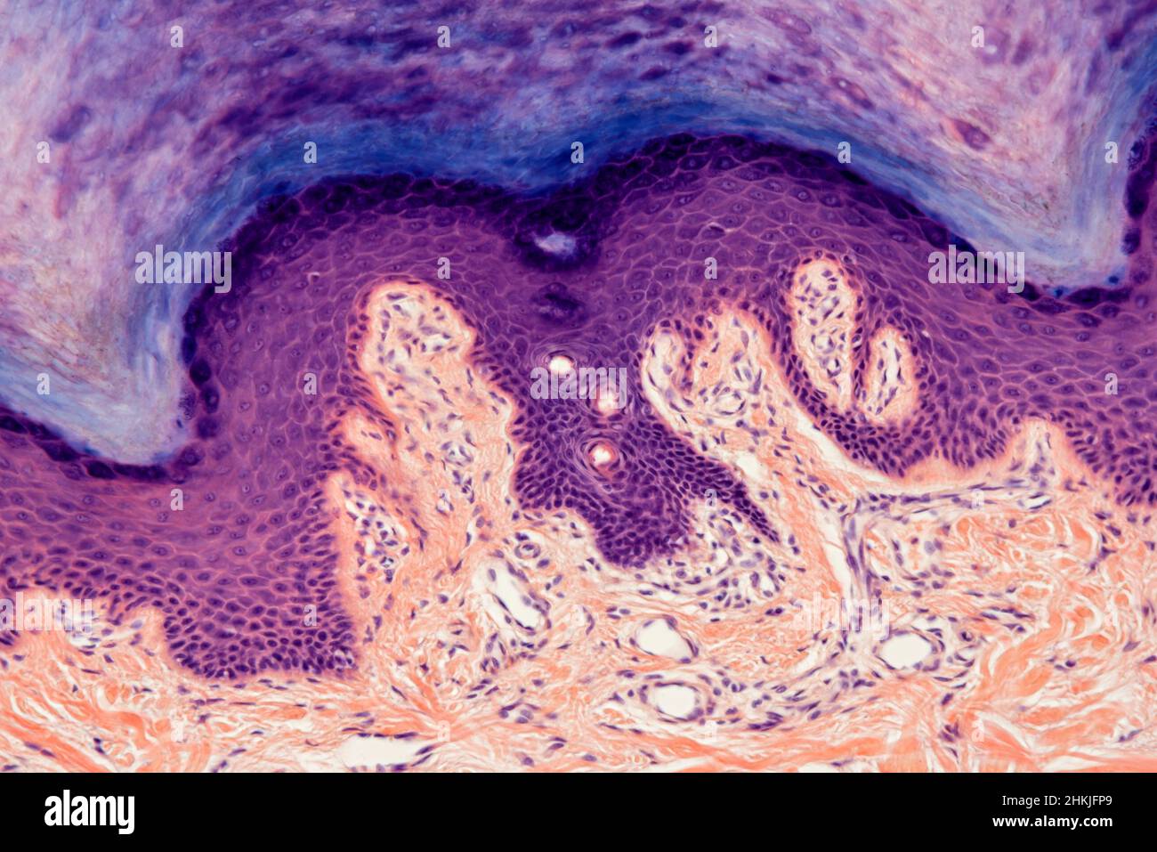 Skin, light micrograph Stock Photo - Alamy