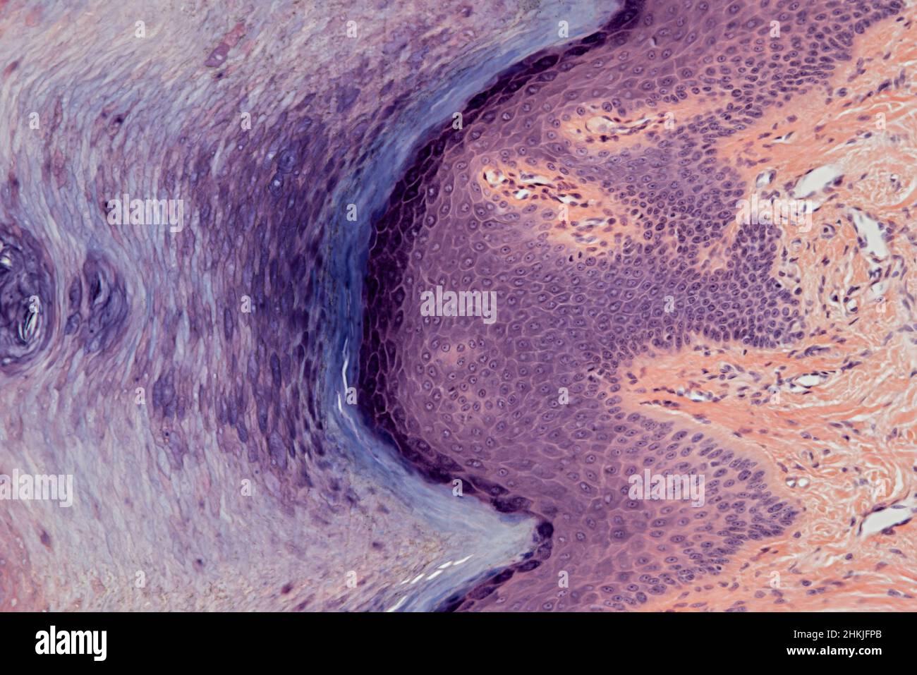Skin, light micrograph Stock Photo - Alamy