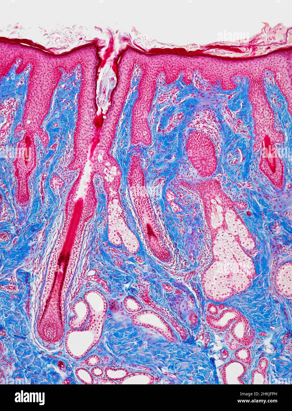 Auditory canal, light micrograph Stock Photo - Alamy