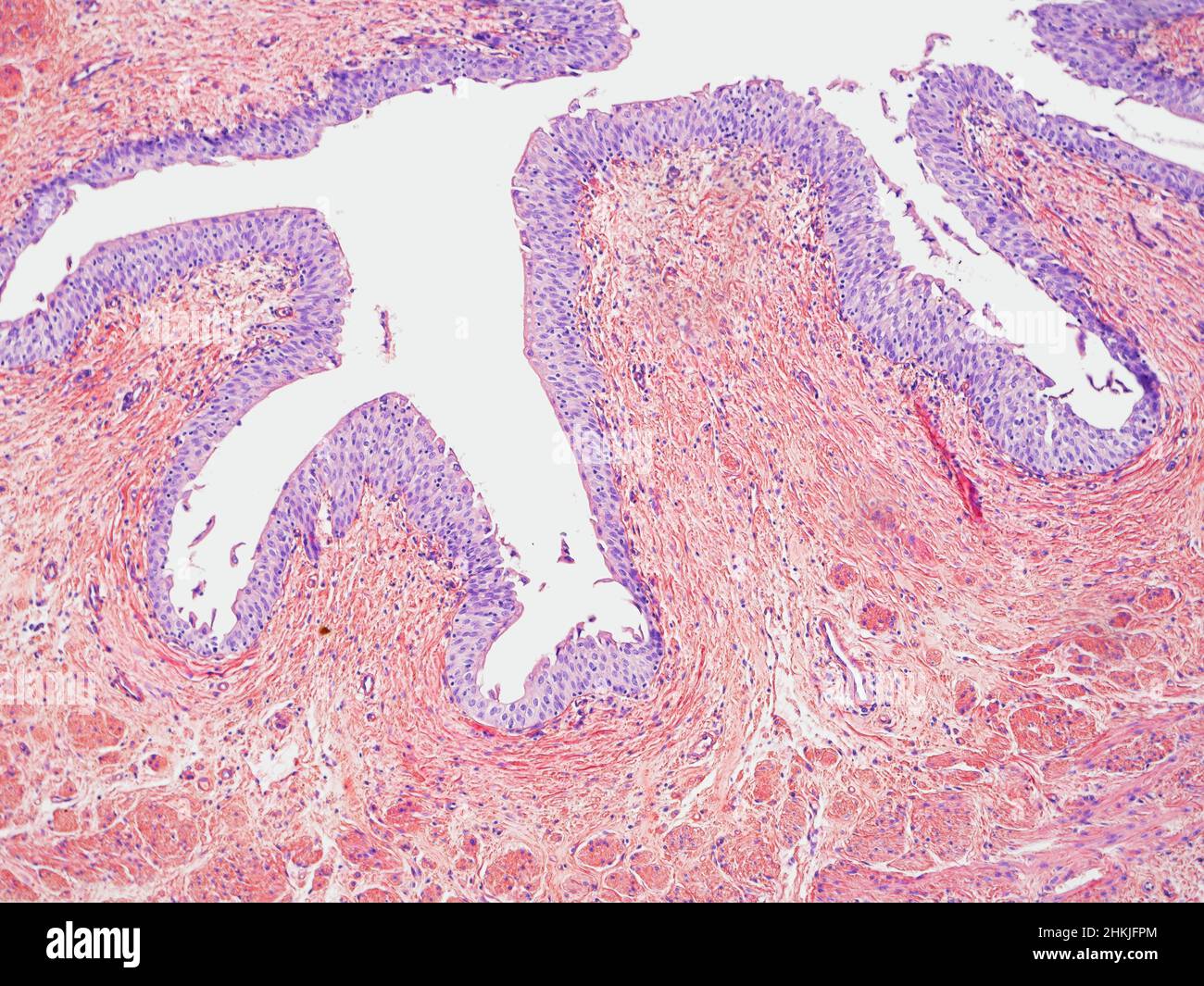 Urethra, light micrograph Stock Photo - Alamy