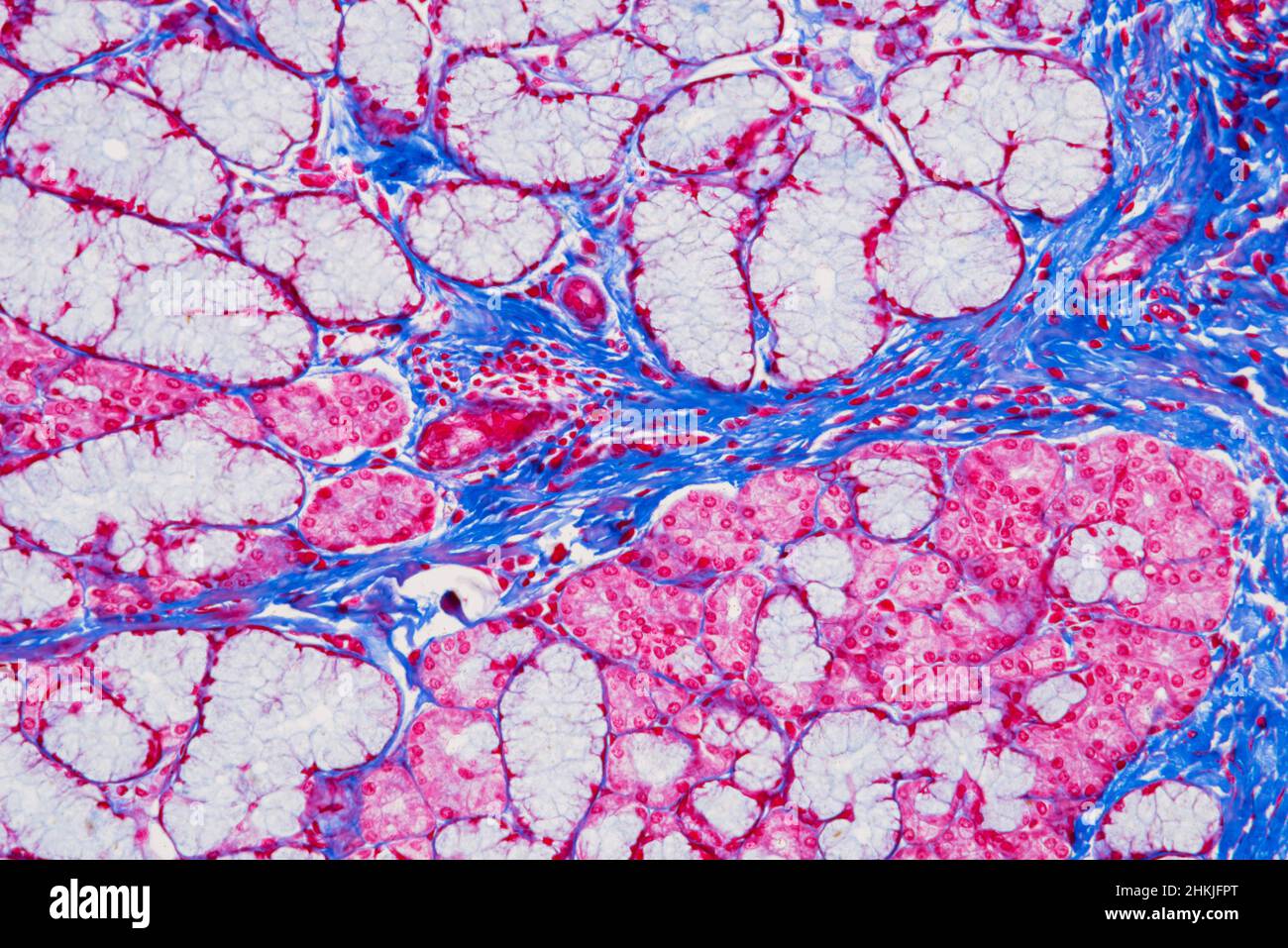 Sublingual salivary gland, light micrograph Stock Photo - Alamy