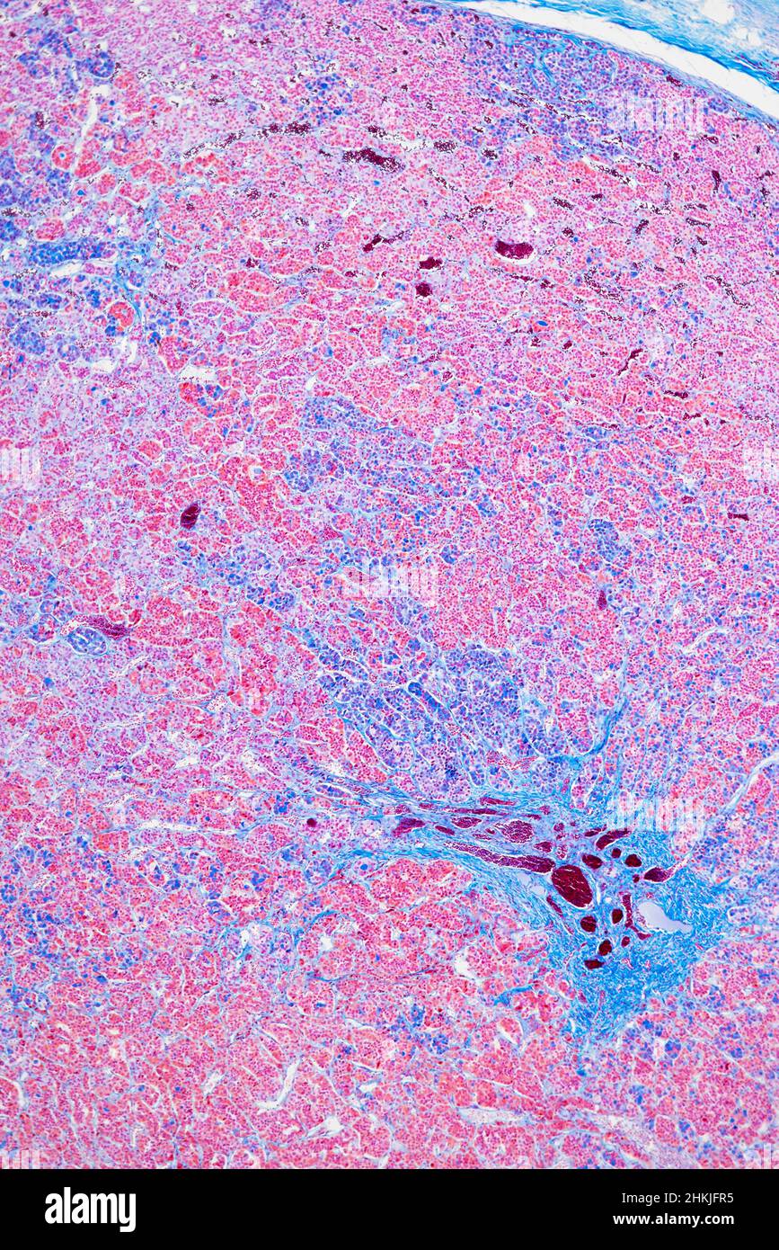 Anterior lobe of the pituitary gland, light micrograph Stock Photo - Alamy