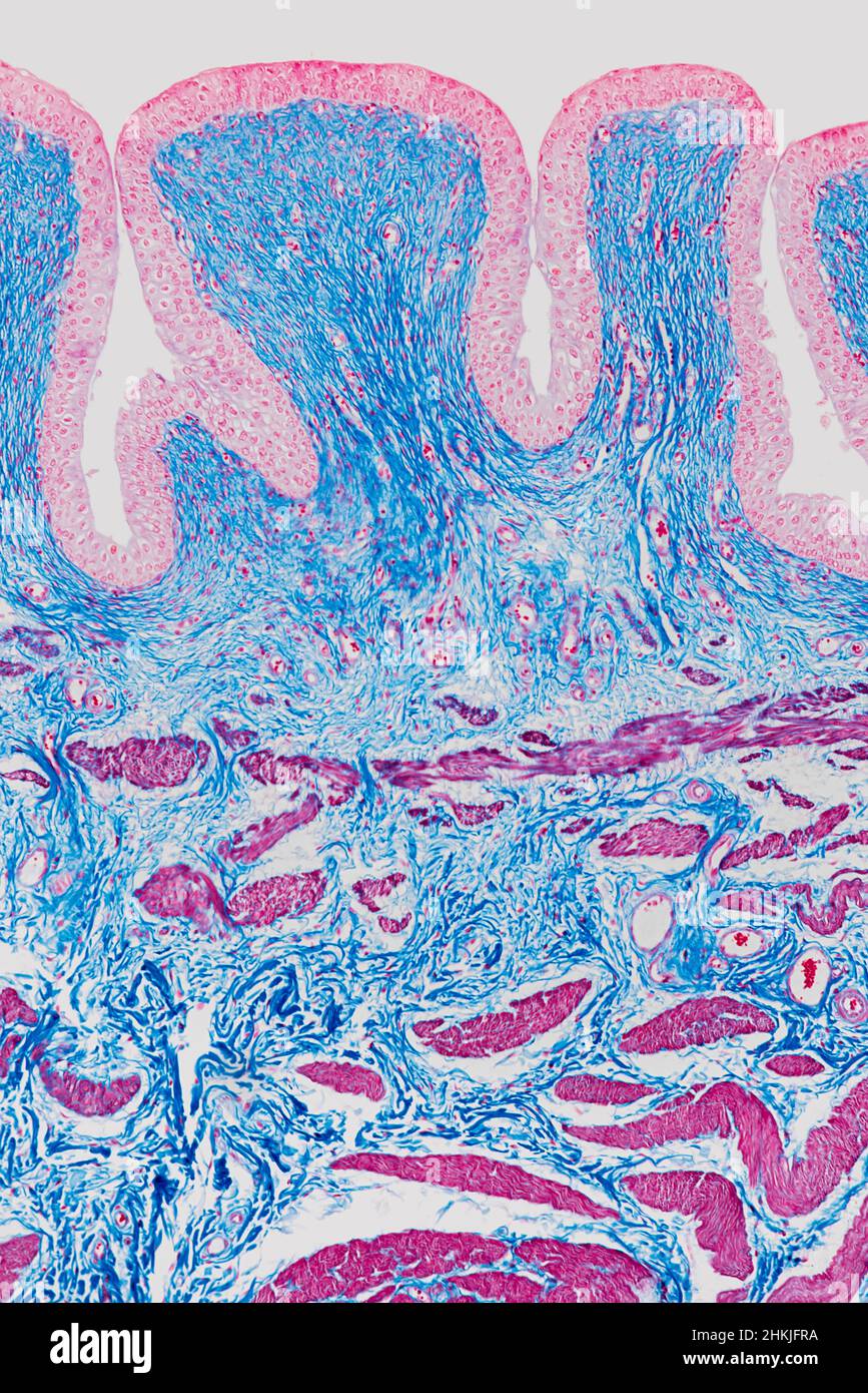 Urinary bladder wall, light micrograph Stock Photo - Alamy